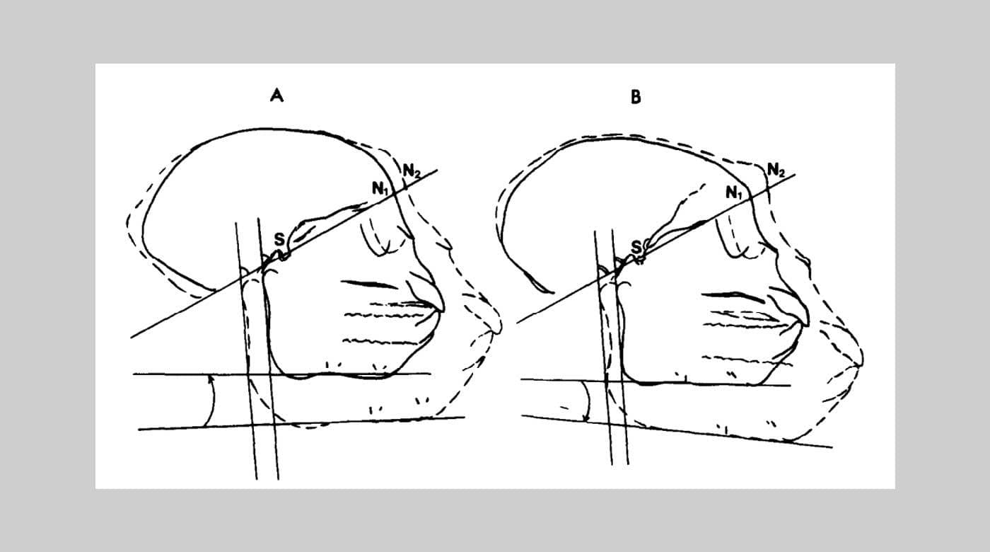 Дышите носом | Ярасту